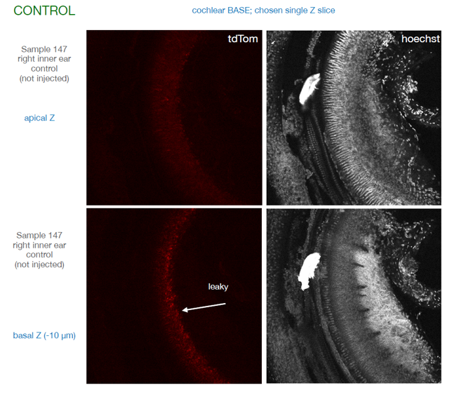Independent validation of Chen delivery platform using LNPs to deliver ...