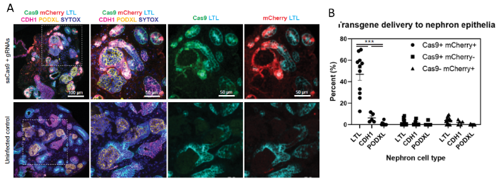 Delivery of saCas9 and gRNAs to nephron epithelia by AAV2 in kidney ...